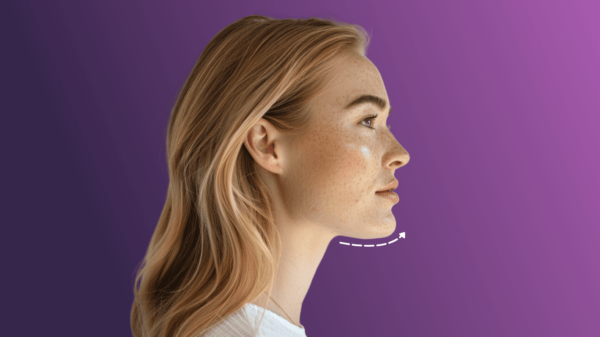 Kinnaufbau mit Hyaluron: Kinn unterspritzen in Berlin & Dresden